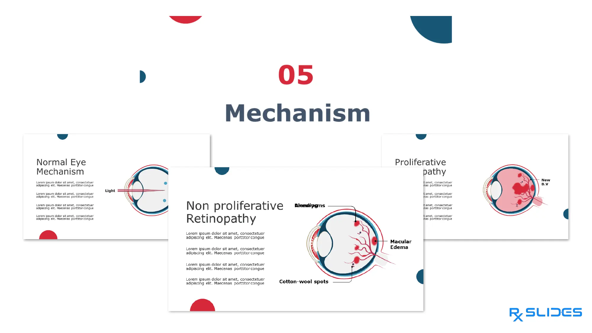 Download Retinopathy PowerPoint Template| RxSlides